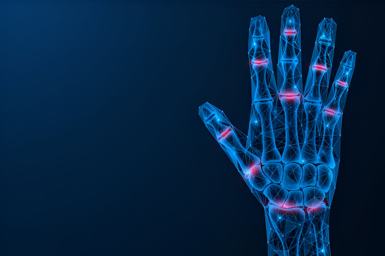 Rheumatoid Arthritis - Advanced Bone Joint Health Specialist